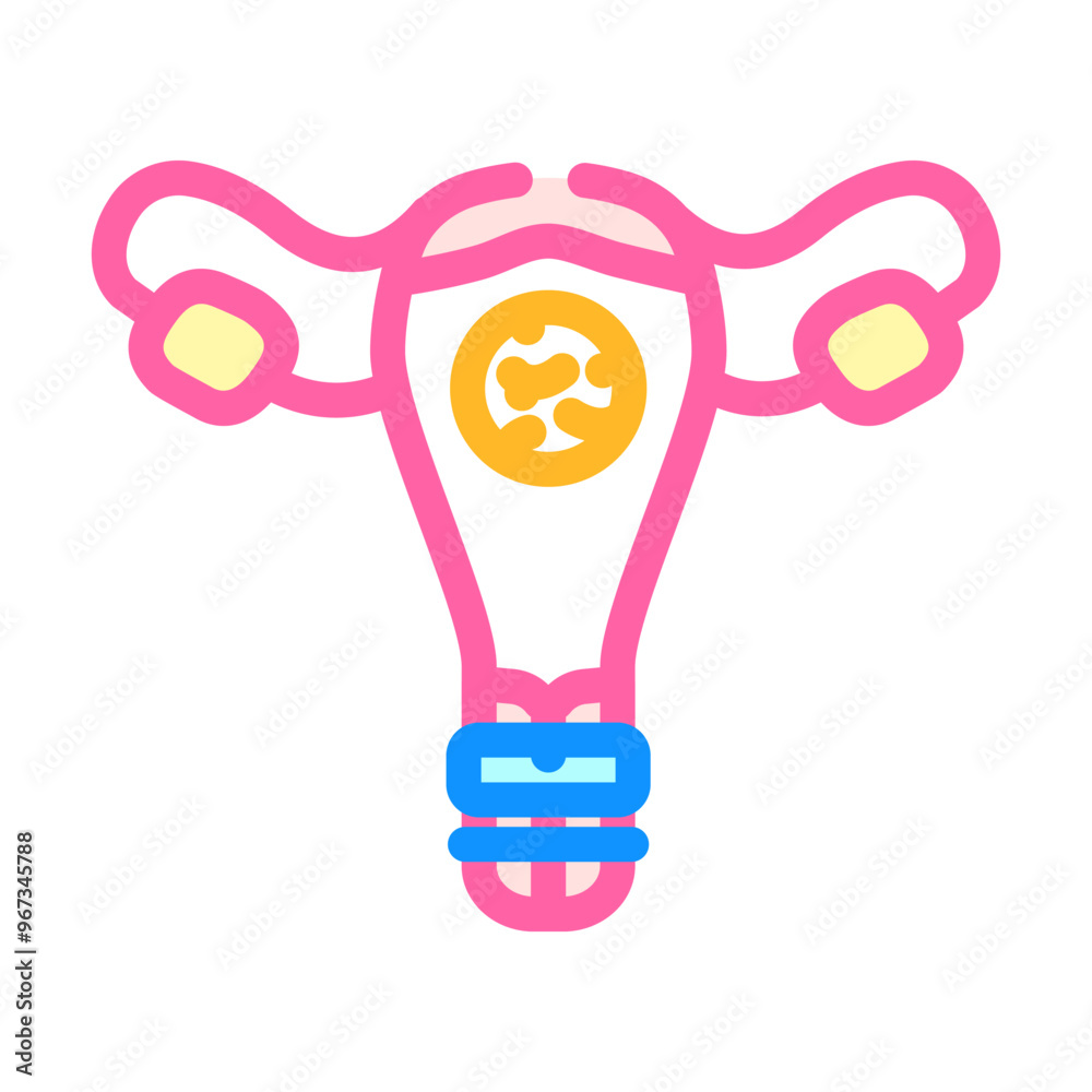 cervical cerclage surgery color icon vector. cervical cerclage surgery ...