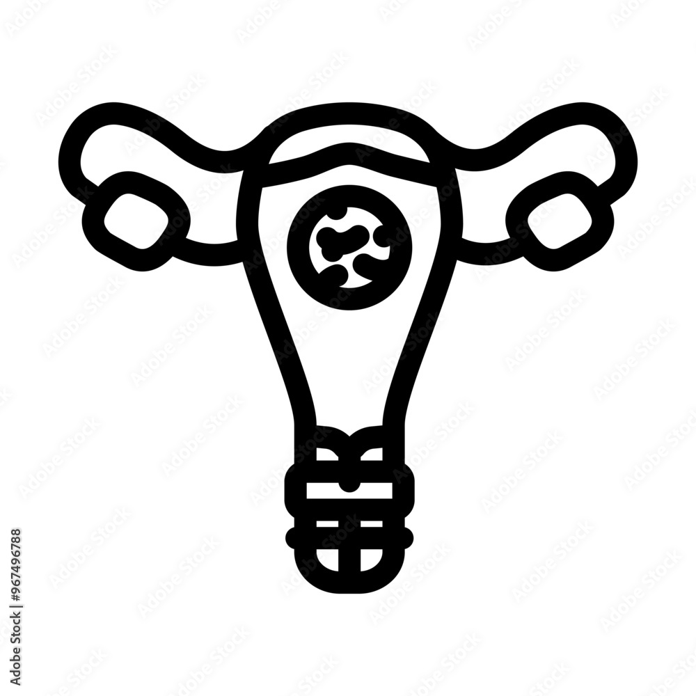 cervical cerclage surgery line icon vector. cervical cerclage surgery ...