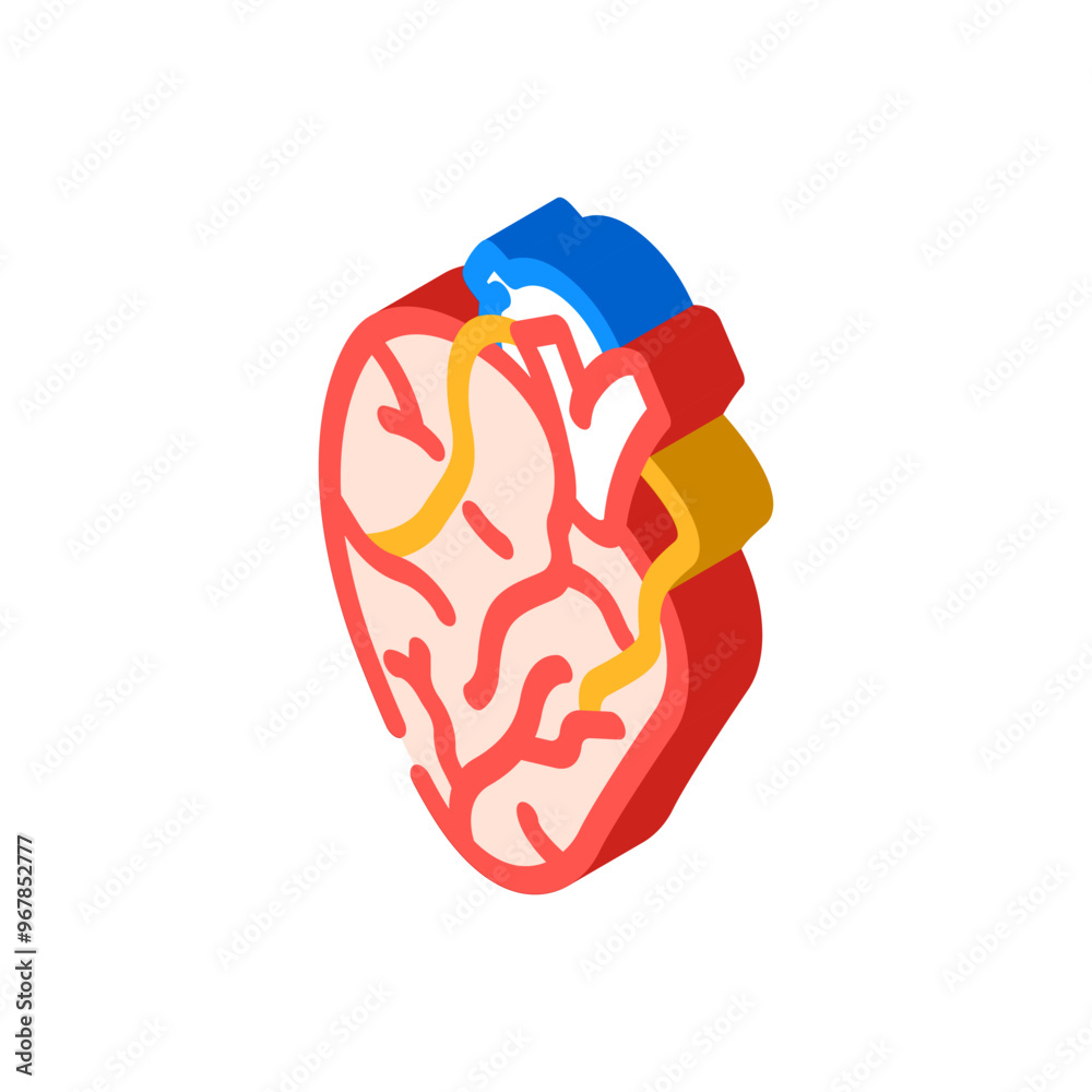 bypass surgery surgery isometric icon vector. bypass surgery surgery ...