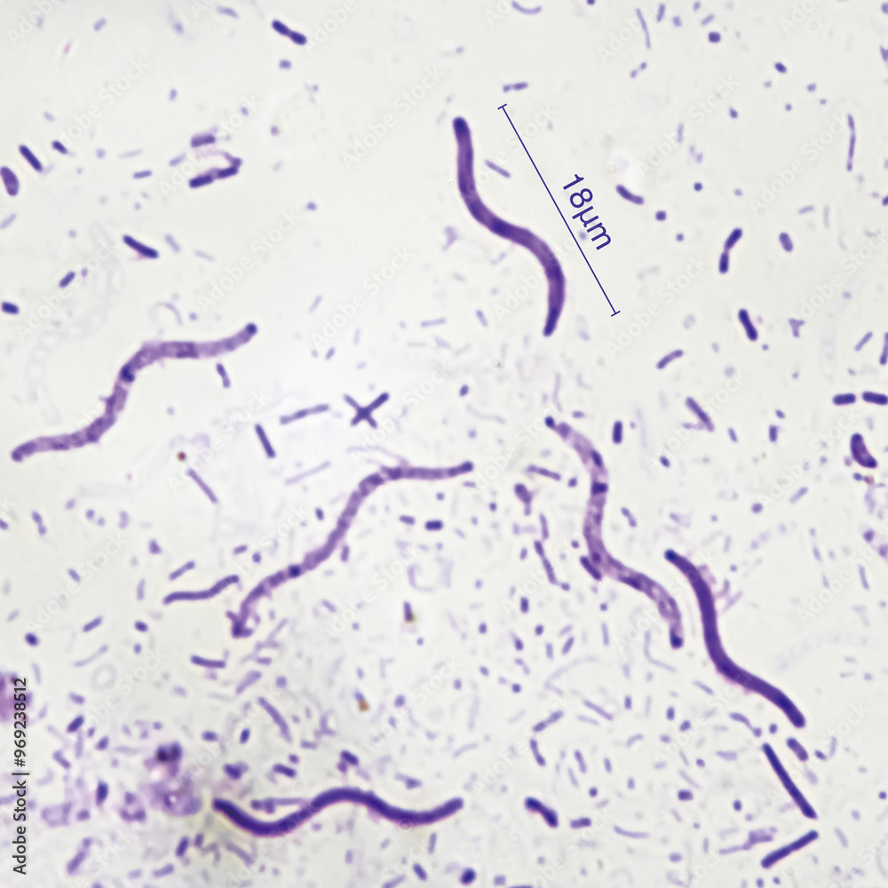 Poster Rhodospirillum Crimson red spirochetes is a spiral shaped ...