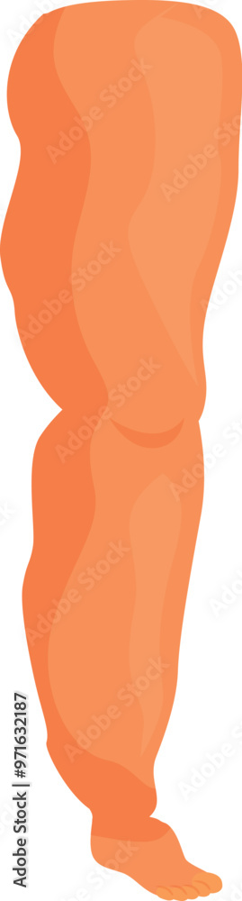 Cartoon illustration of a human leg with elephantiasis, highlighting ...