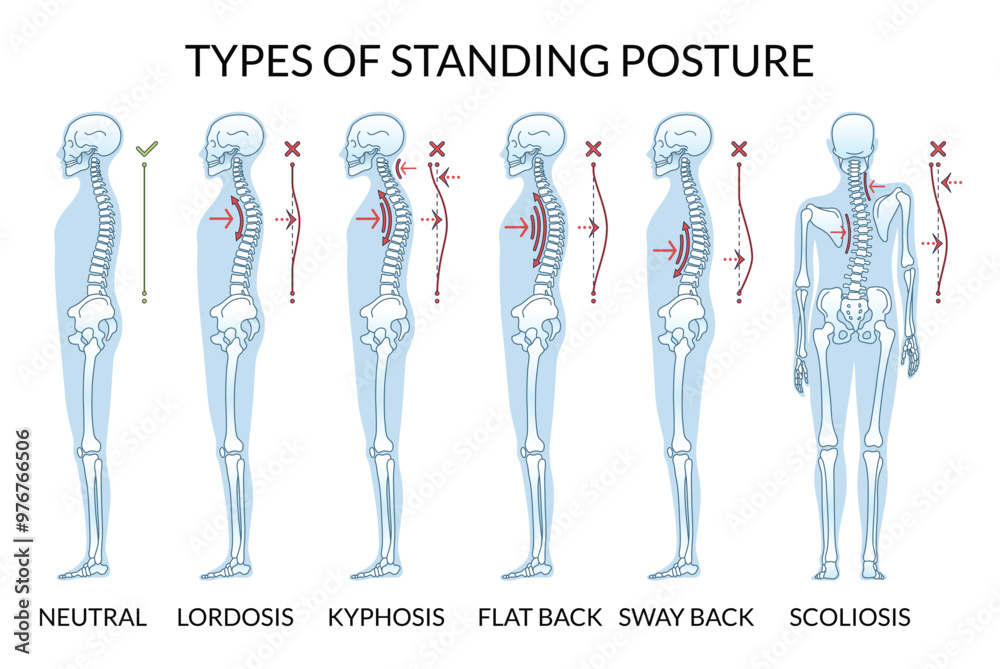 Understanding the Different Types of Standing Posture for Achieving ...