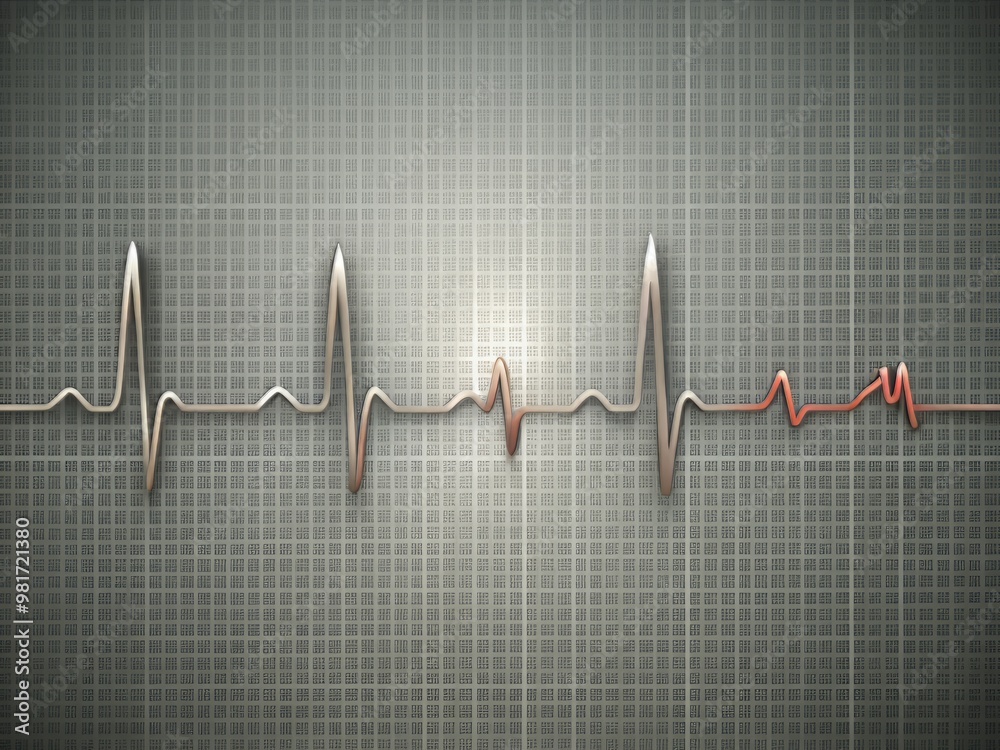 A highly detailed and realistic illustration of an ECG tracing with a ...