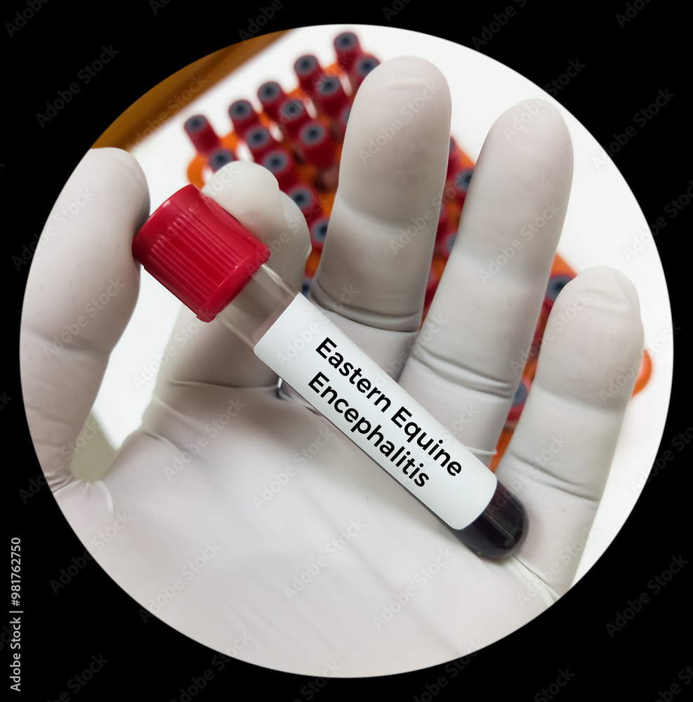 Blood test sample for Eastern equine encephalitis (EEE) virus test ...