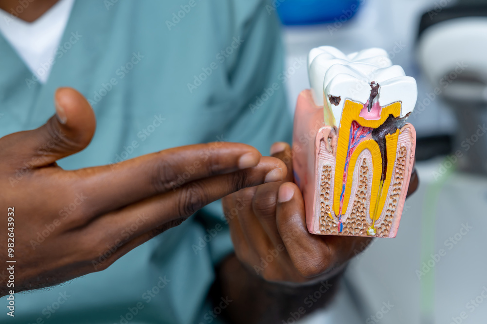 Model in the clinic displaying the structure of teeth, including enamel ...