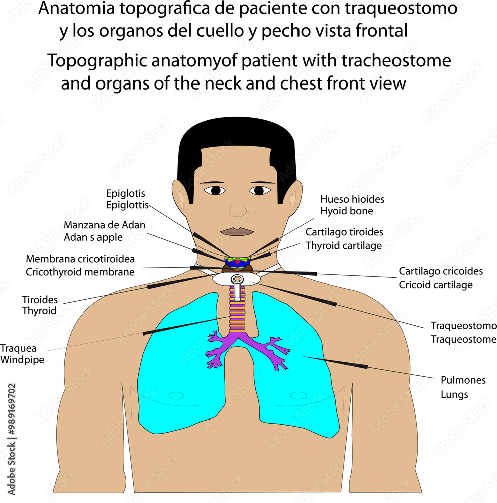 Anatomia topografica de paciente con traqueostomo y los organos del ...