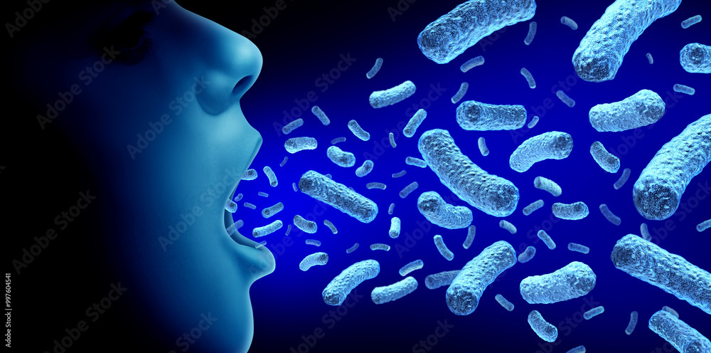 Whooping Cough Pertussis as a contagious respiratory disease with the bacterium Bordetella ...