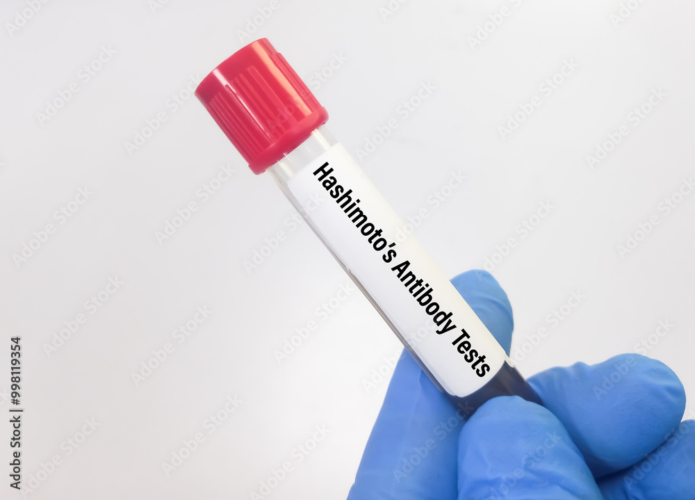 Blood sample for Thyroid function tests or thyroid panel test (T3,T4 ...