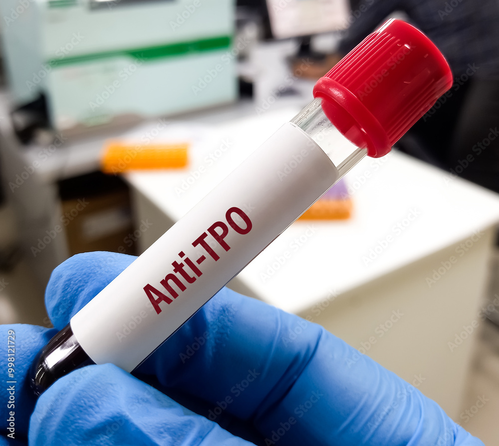 Blood sample for Thyroid Peroxidase Antibodies or Anti-TPO test and ...