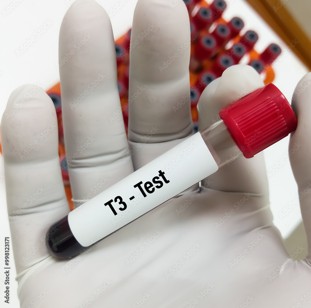 Blood sample for Thyroid function tests or thyroid panel test (T3,T4 ...