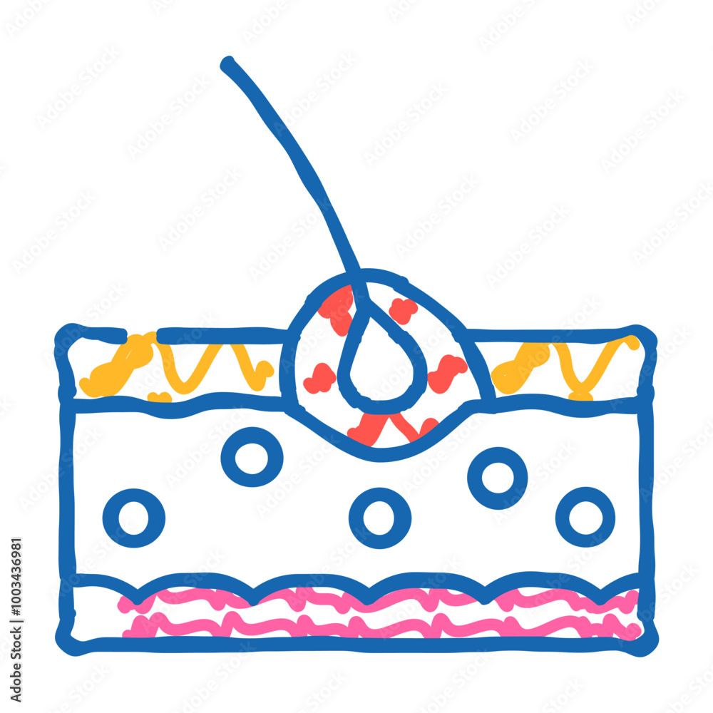 folliculitis skin disease problem doodle icon sketch vector ...