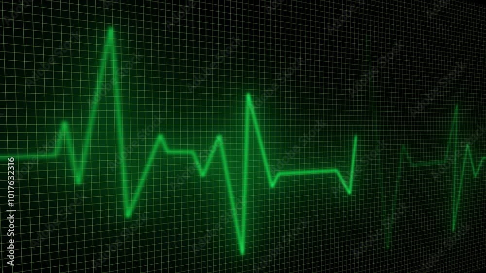 Heartbeat monitor animation A smooth animation in high quality on a ...