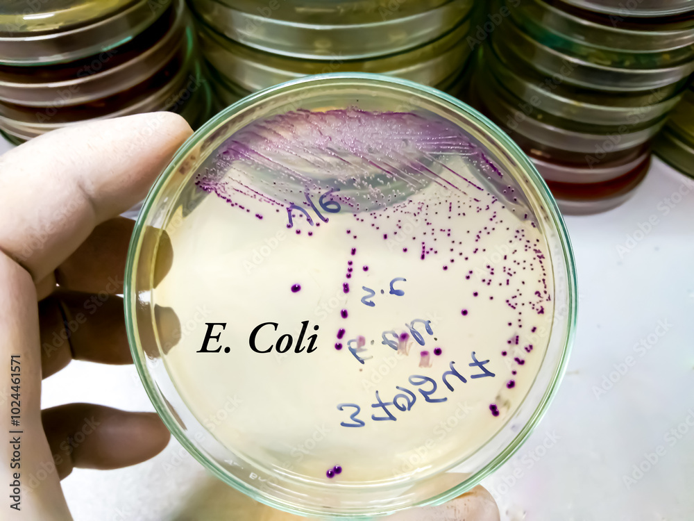 Medical technologist holds Bacteria culture growth on chromogenic media ...