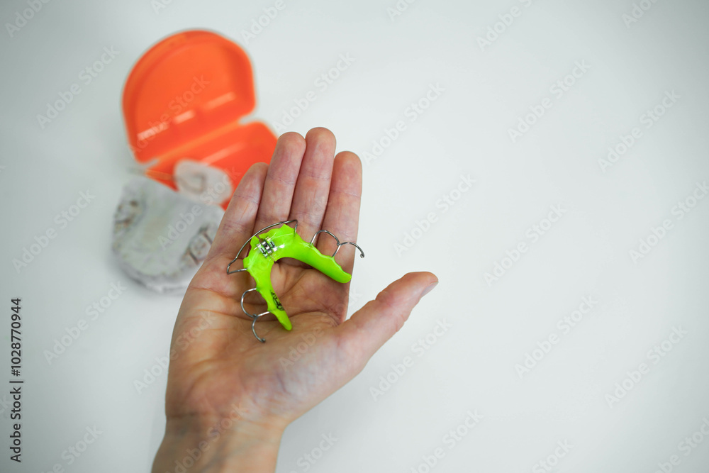 Dentist set of palatal braces for young patient. Jaw correction. Dental ...