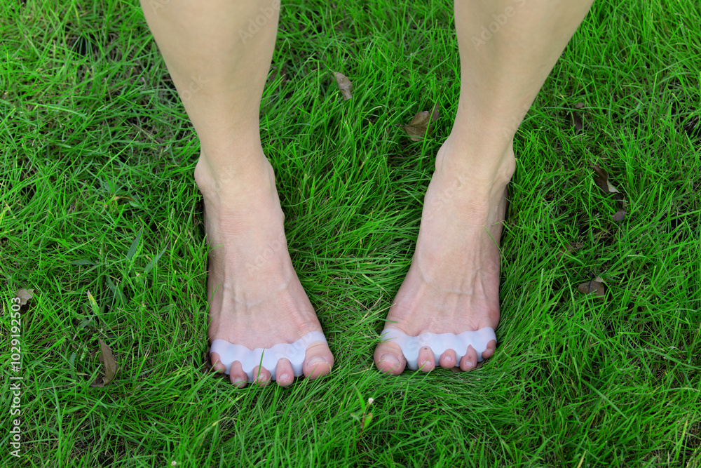 A woman's bare feet on a green grass background, wearing a silicone toe ...