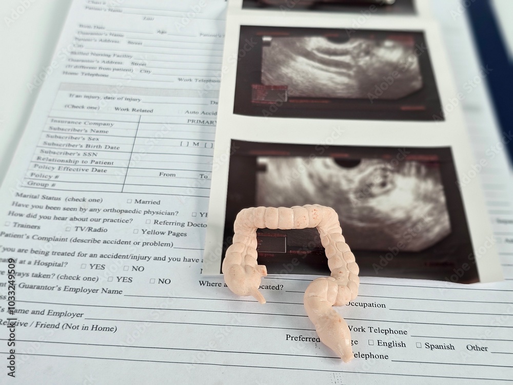 Details of a medical examination with a 3D colon model alongside ...