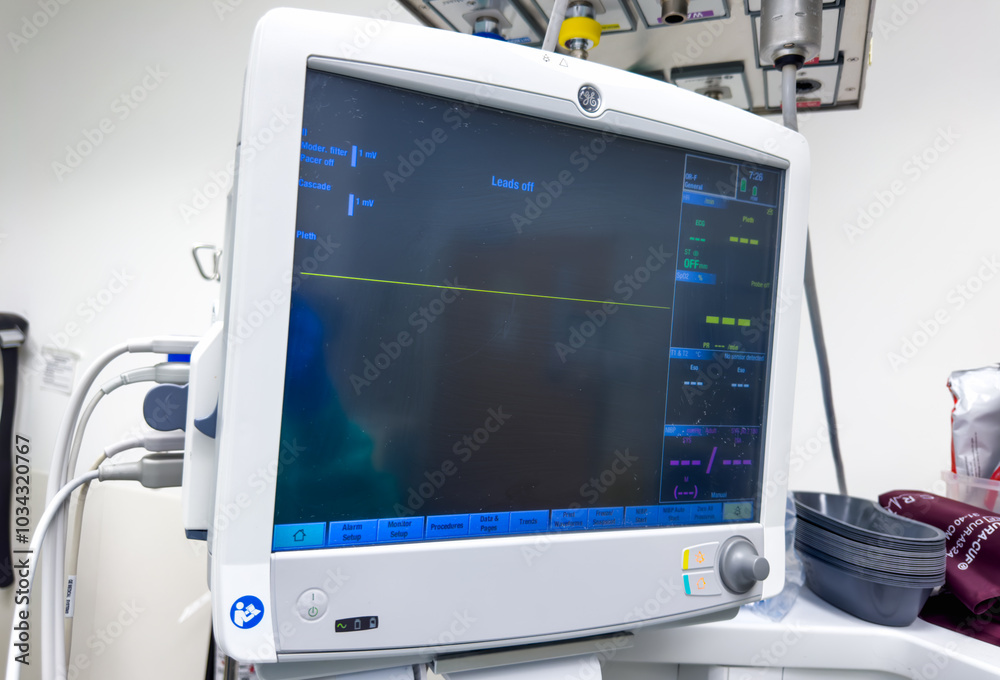 hospital monitors displaying vital signs, including heart rate, oxygen ...