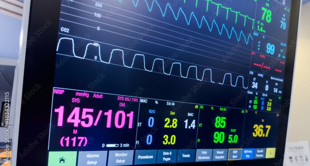 hospital monitors displaying vital signs, including heart rate, oxygen ...