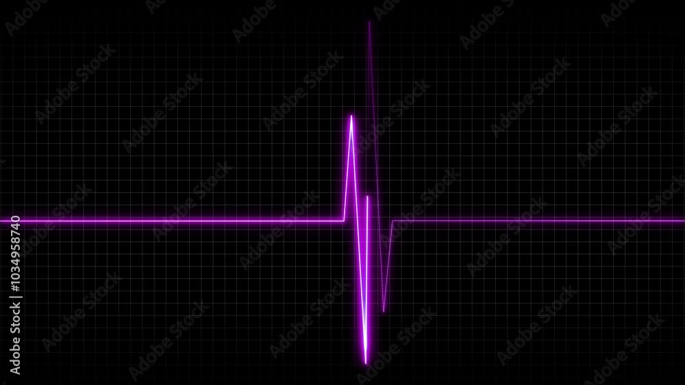 Heart signs in surgery. Screening patient heart. Vital signs monitor ...