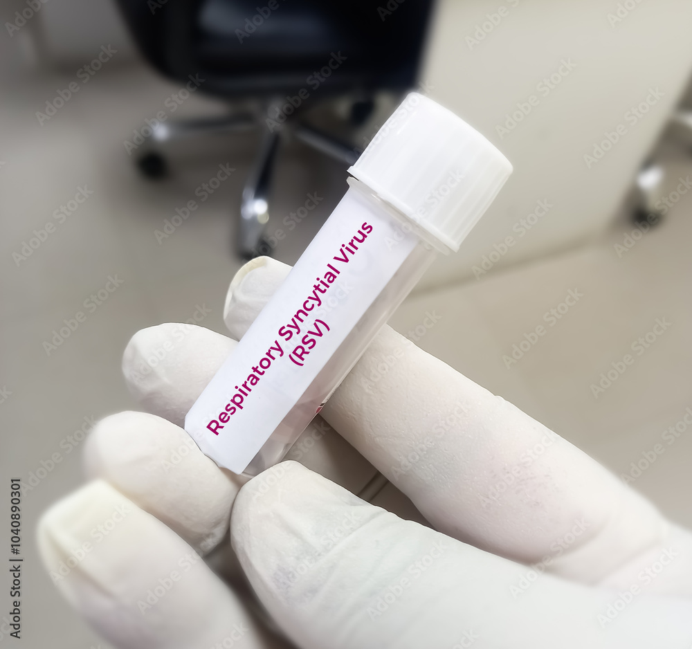 Swab sample for RSV (respiratory syncytial virus) test, common ...