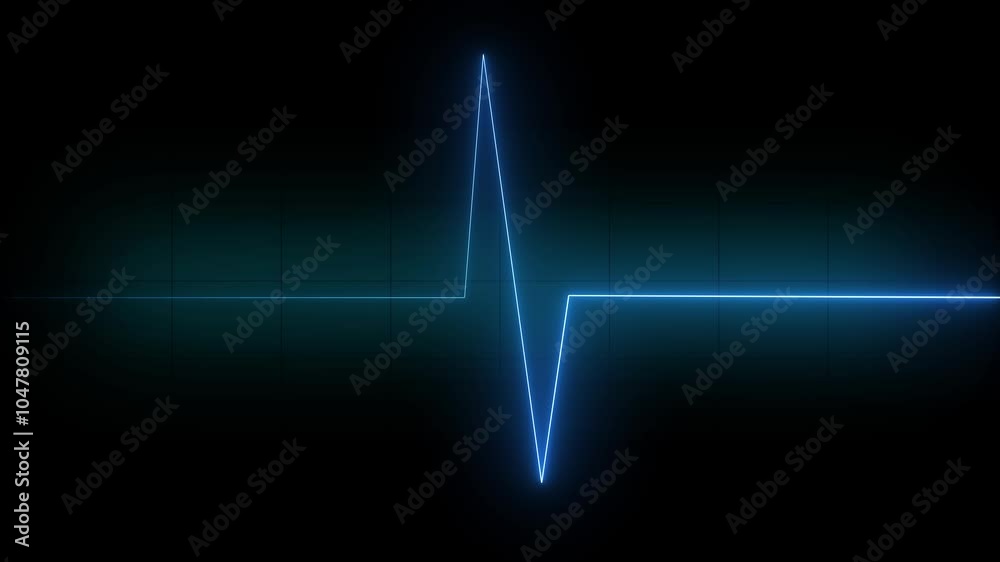 Dynamic heart rate or heart beat line. Patient monitor displays vital ...