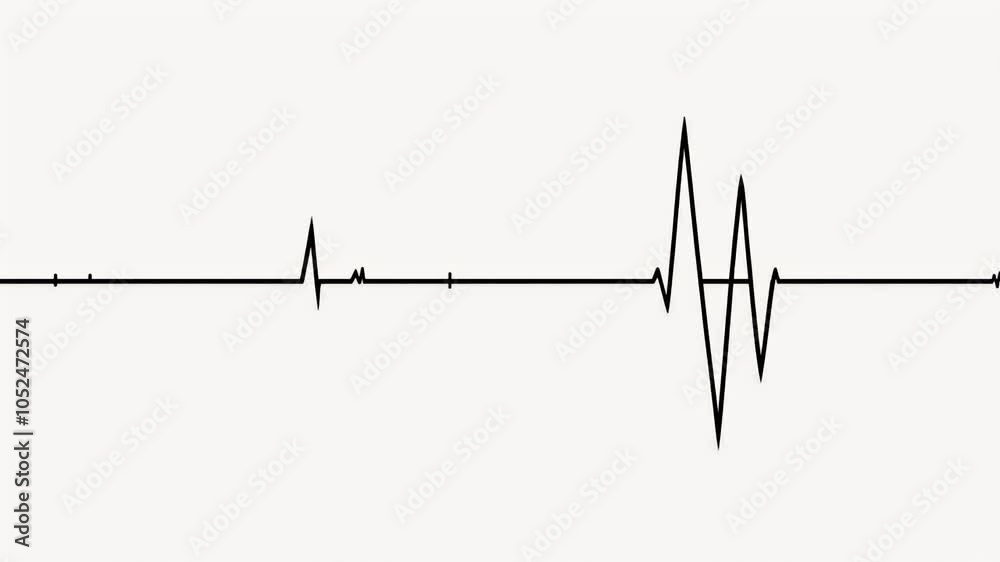 A captivating electrocardiogram EKG animation illustrates artbeats ...