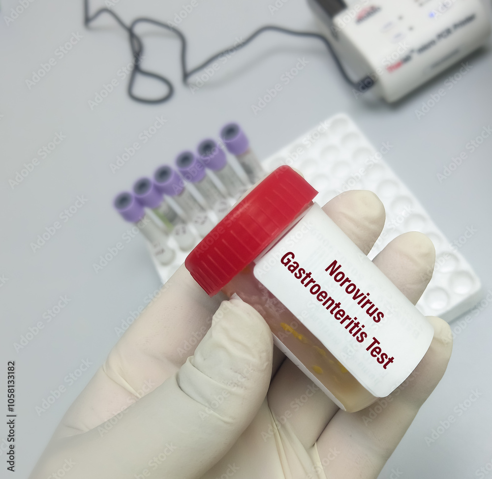 Stool test sample for Norovirus Test in doctor hand. Norovirus ...
