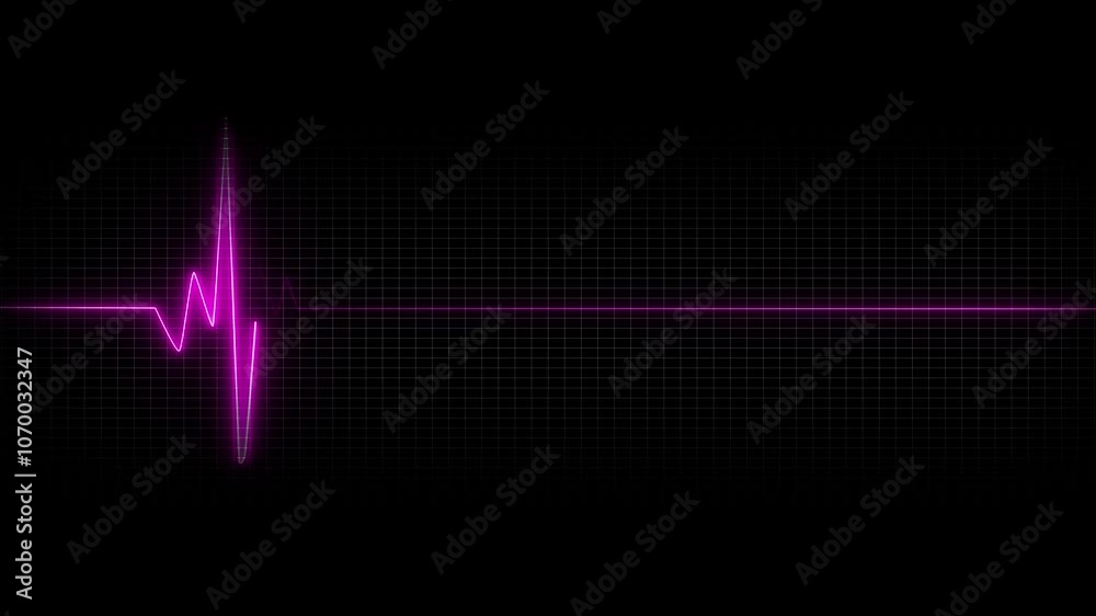 Dynamic heart rate or heart beat line. Patient monitor displays vital ...