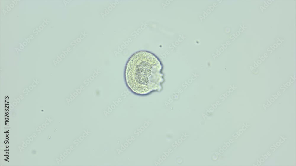 Larva sea urchin Strongylocentrotus pallidus under microscope, phylum ...