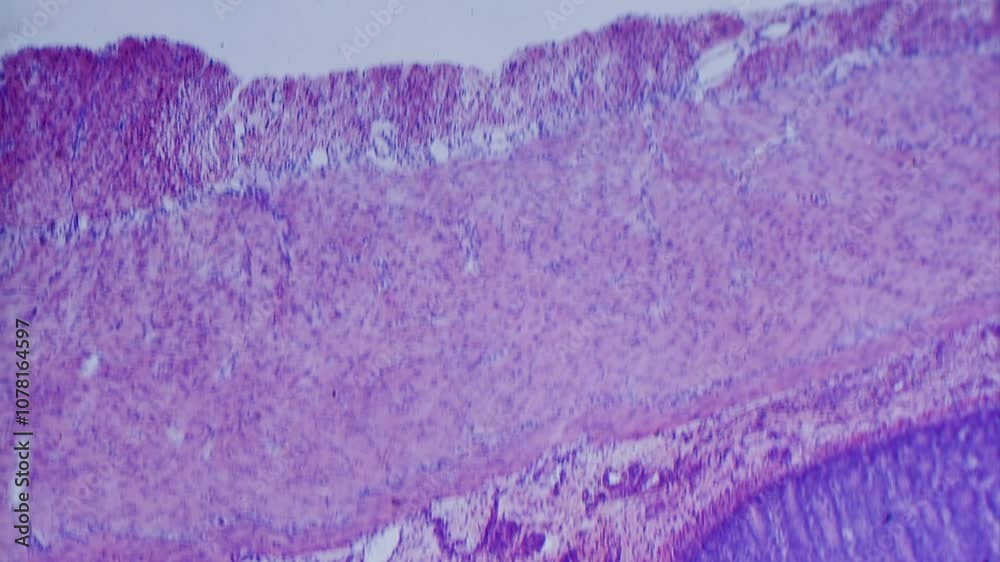 Large intestine transverse section stained un der microscope bright ...