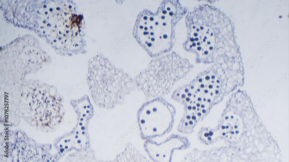 Stained stem of monocotyledon transverse section under microscope ...