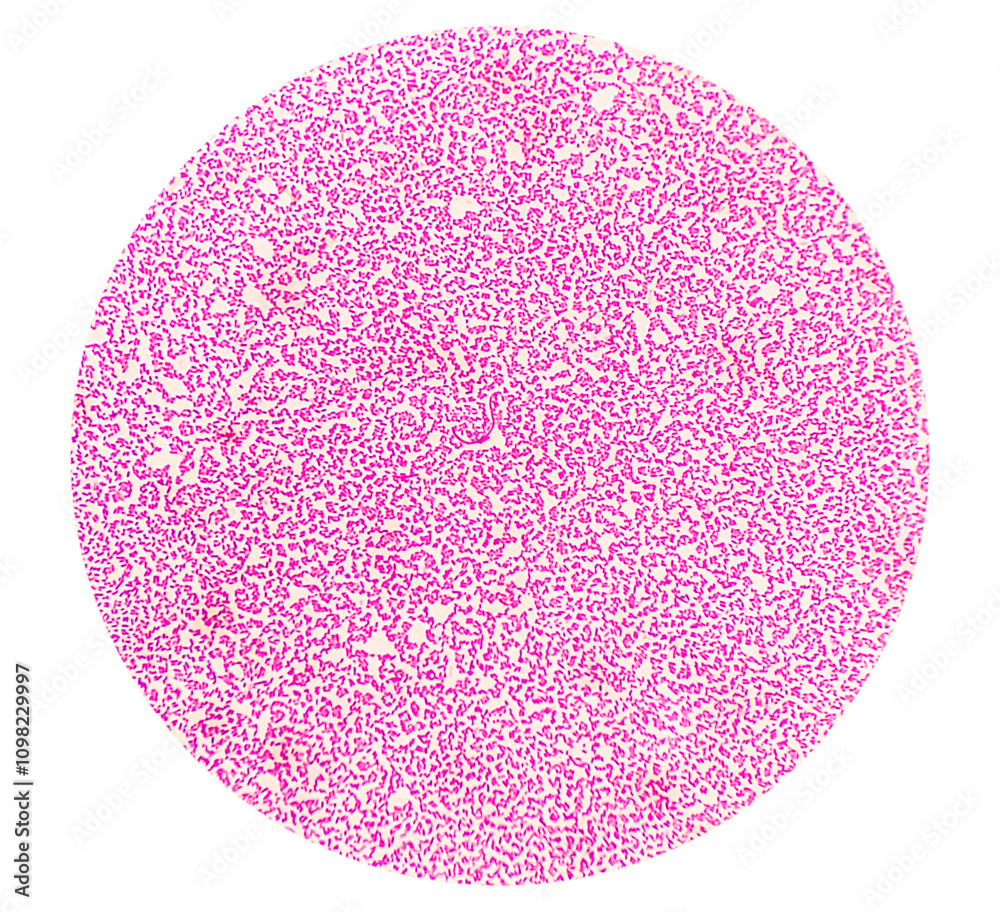 Salmonellosis. Microscopic view of gram stained slide from blood agar ...