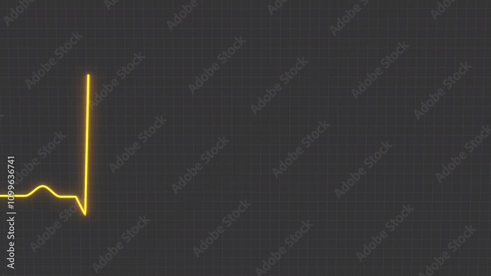 ECG, electrocardiogram of a healthy person, normal heart rhythm. Looped ...