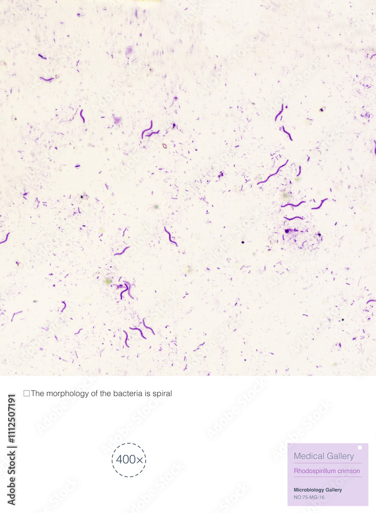 Crimson red spirochetes is a spiral shaped bacterium that is Gram ...