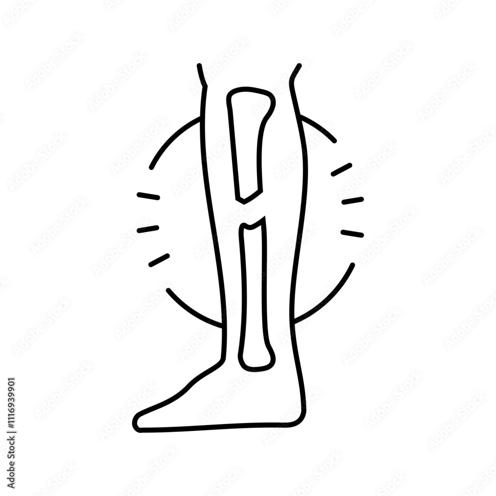broken leg fracture injury line icon vector. broken leg fracture injury ...