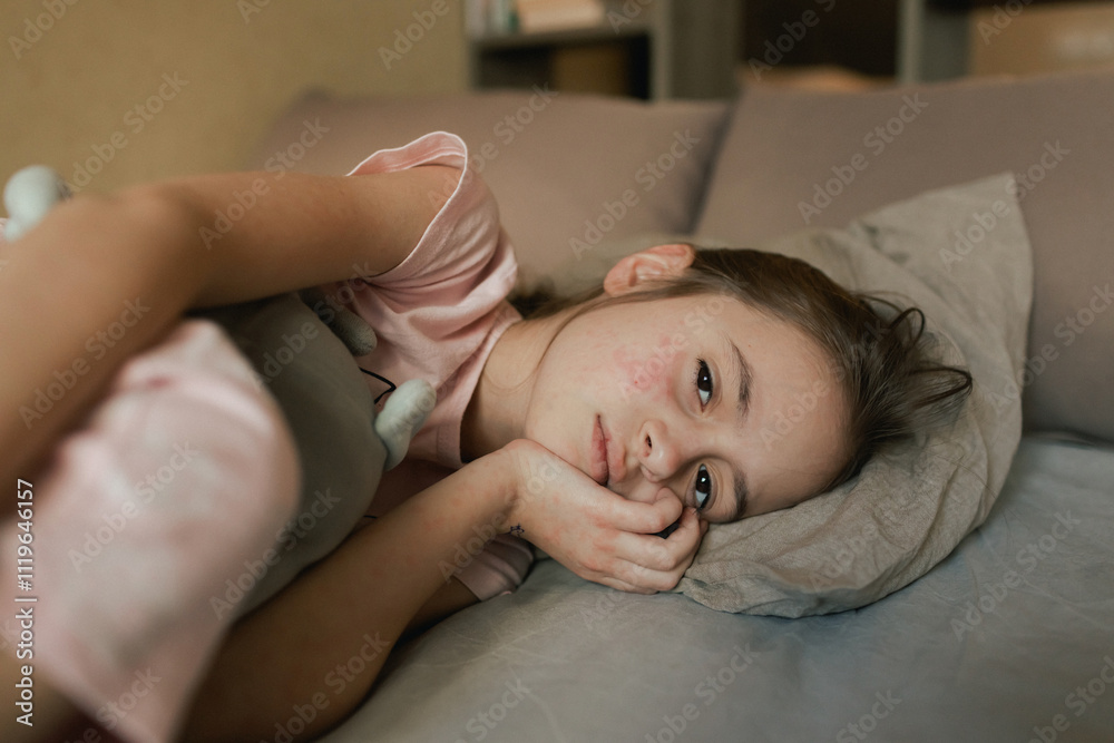 A sick child with skin rashes in bed. Child's skin with many red spot ...