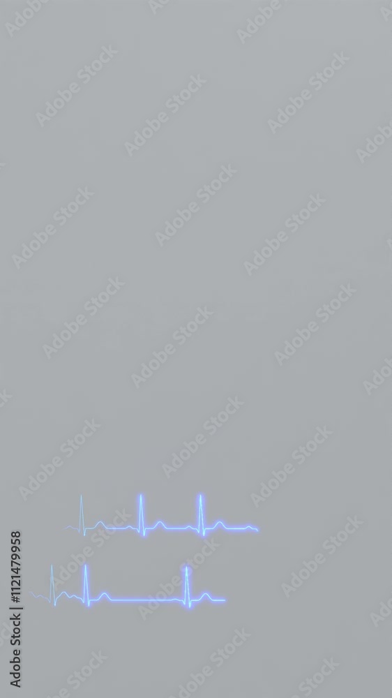 ECG graphs comparison of normal heart rhythm and arrhythmia vídeo do ...
