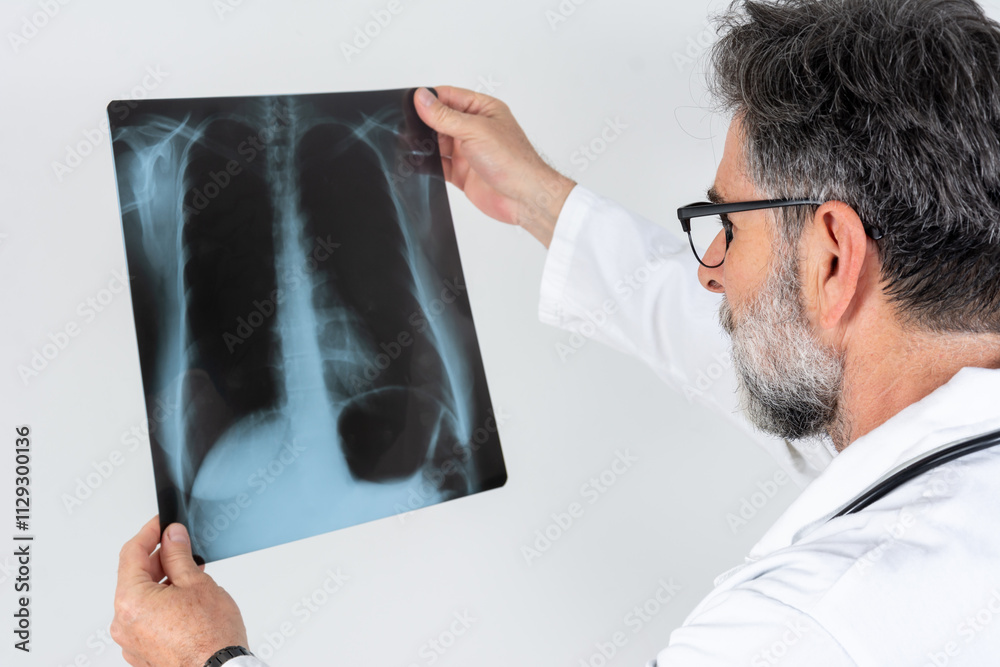 Doctor examining a lung radiography. Doctor examining a radiography ...