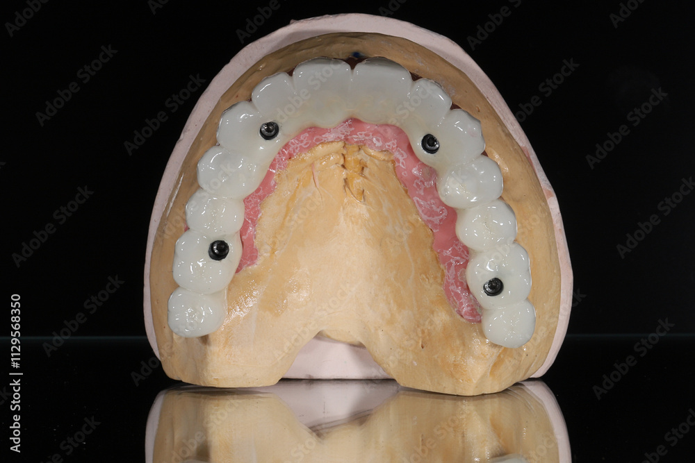 Full-arch dental prosthesis torque wrench and dental implant wrench ...