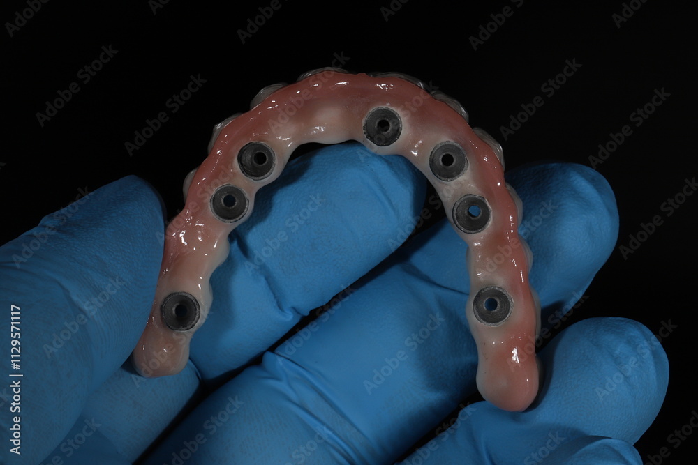 Full-arch dental prosthesis torque wrench and dental implant wrench ...