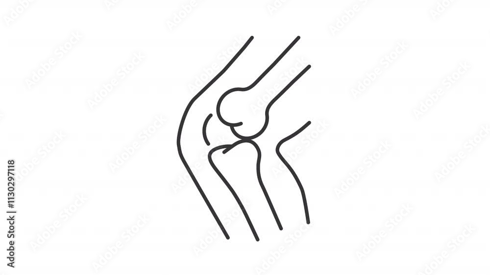 Knee rheumatism line animation. Reactive arthritis animated icon ...