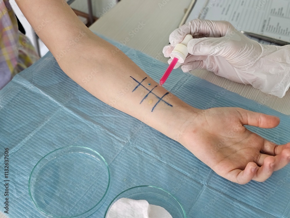 Poster Skin allergy testing in a clinical setting with a patient ...