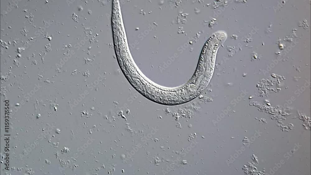 Nematode Parasite in canine feces under microscope vídeo de Stock ...