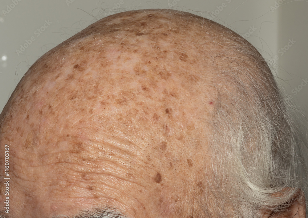 Detailed close-up of an elderly individual's head, focusing on the ...