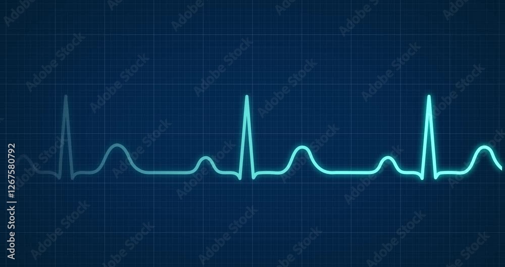 Stockvideon Dynamic electrocardiogram ECG waveform on dark blue medical ...