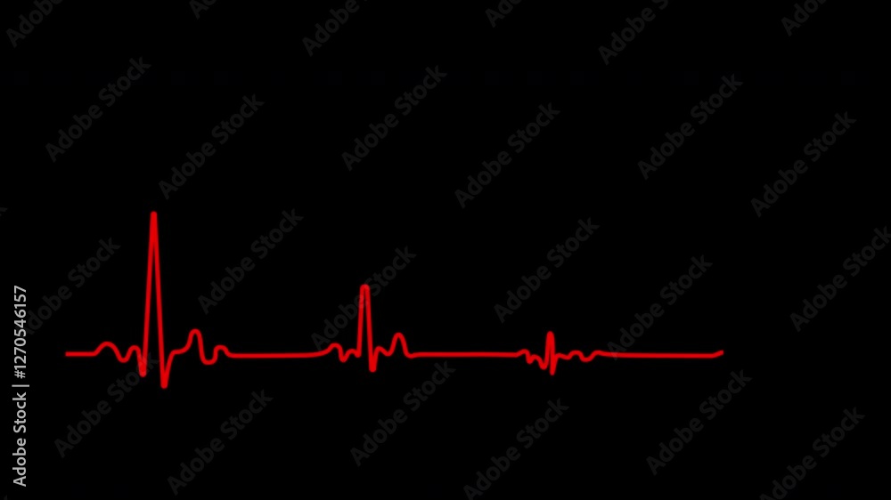 Heart failure, cardiac arrest, wave attenuation chart self drawing ...