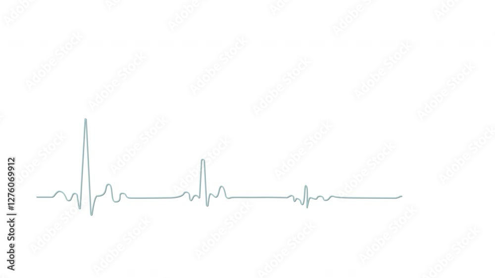 Heart failure, cardiac arrest, wave attenuation chart self drawing ...