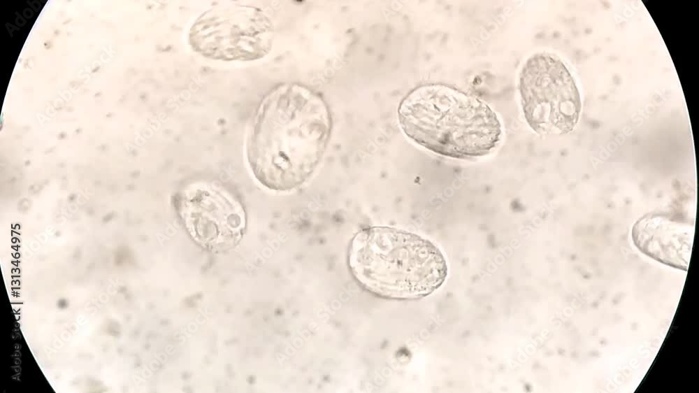 Schistosoma Spp. Parasite egg in human urine specimen under microscope ...
