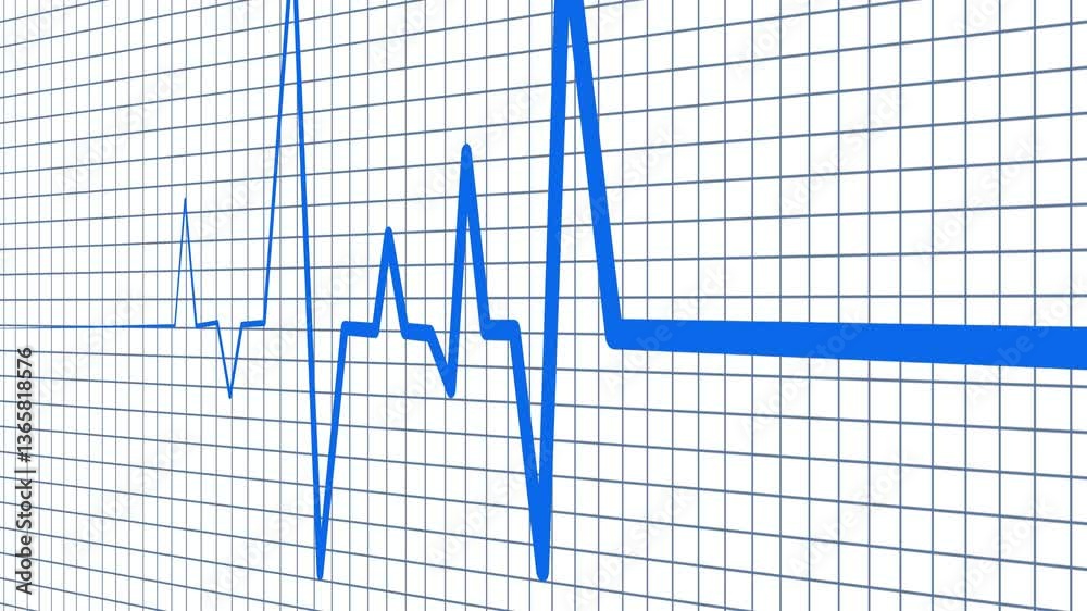 ECG Heartbeat Line Graph on Grid Background Animation, A ...