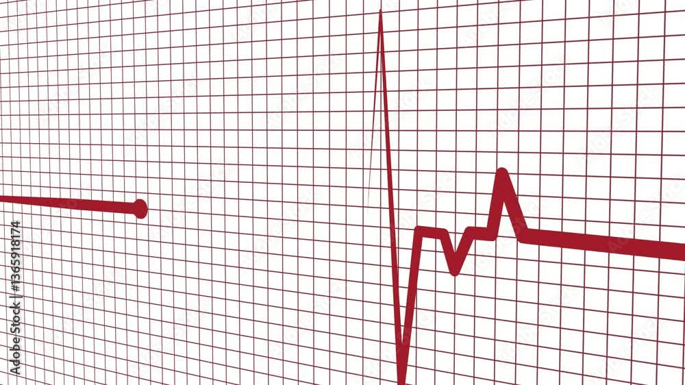 Electrocardiogram Heartbeat Line Graph Animation, A electrocardiogram ...